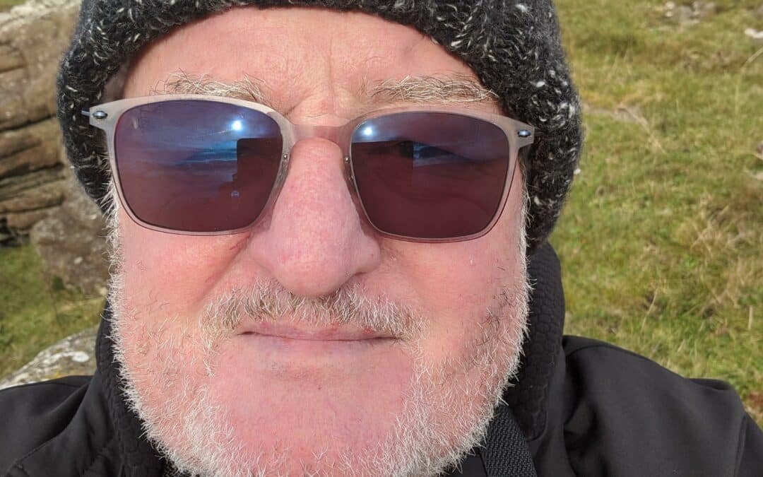 The Ocularist: Part 3! | Childhood Eye Cancer Trust