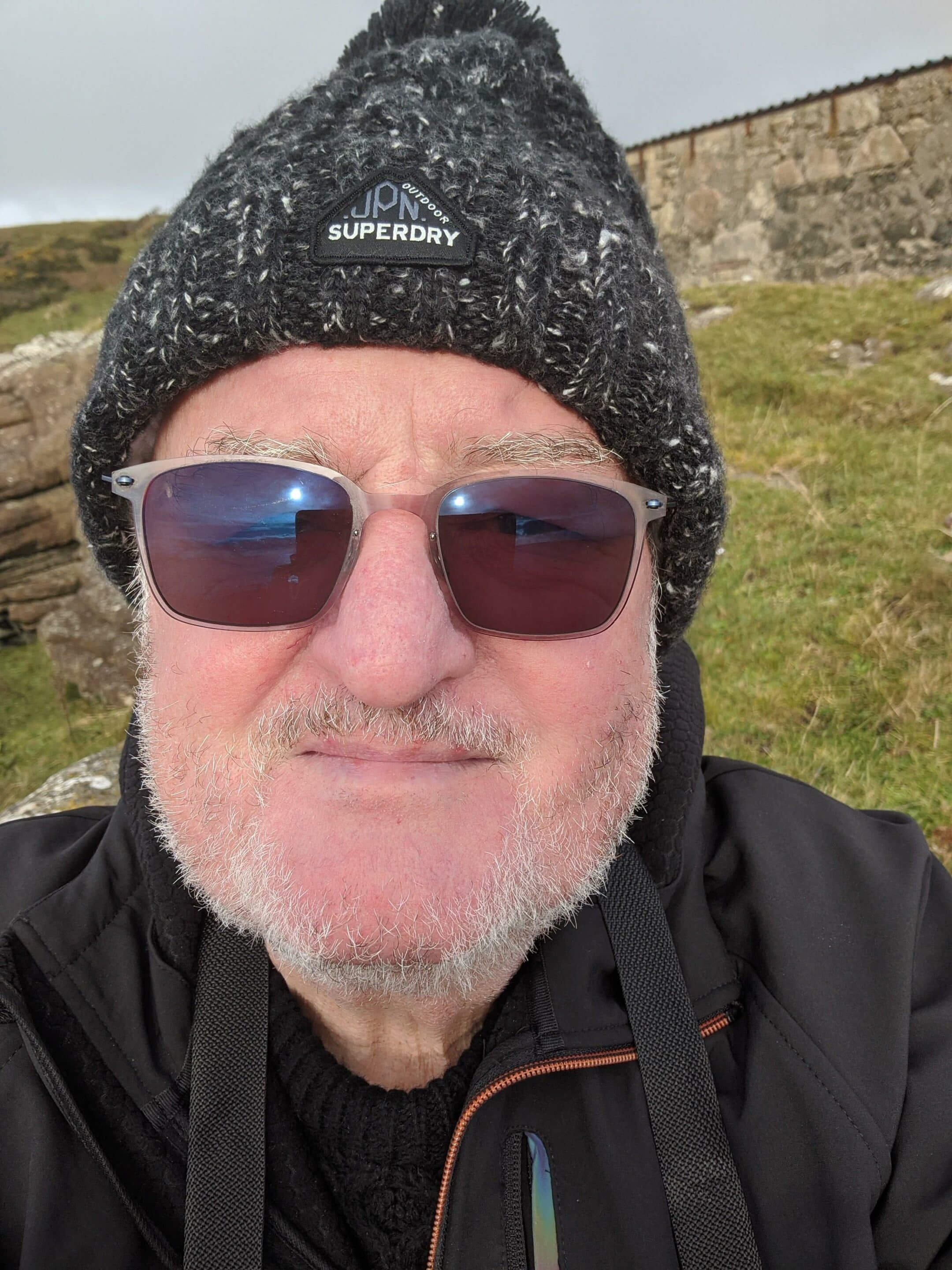 The Ocularist…Continued! | Childhood Eye Cancer Trust