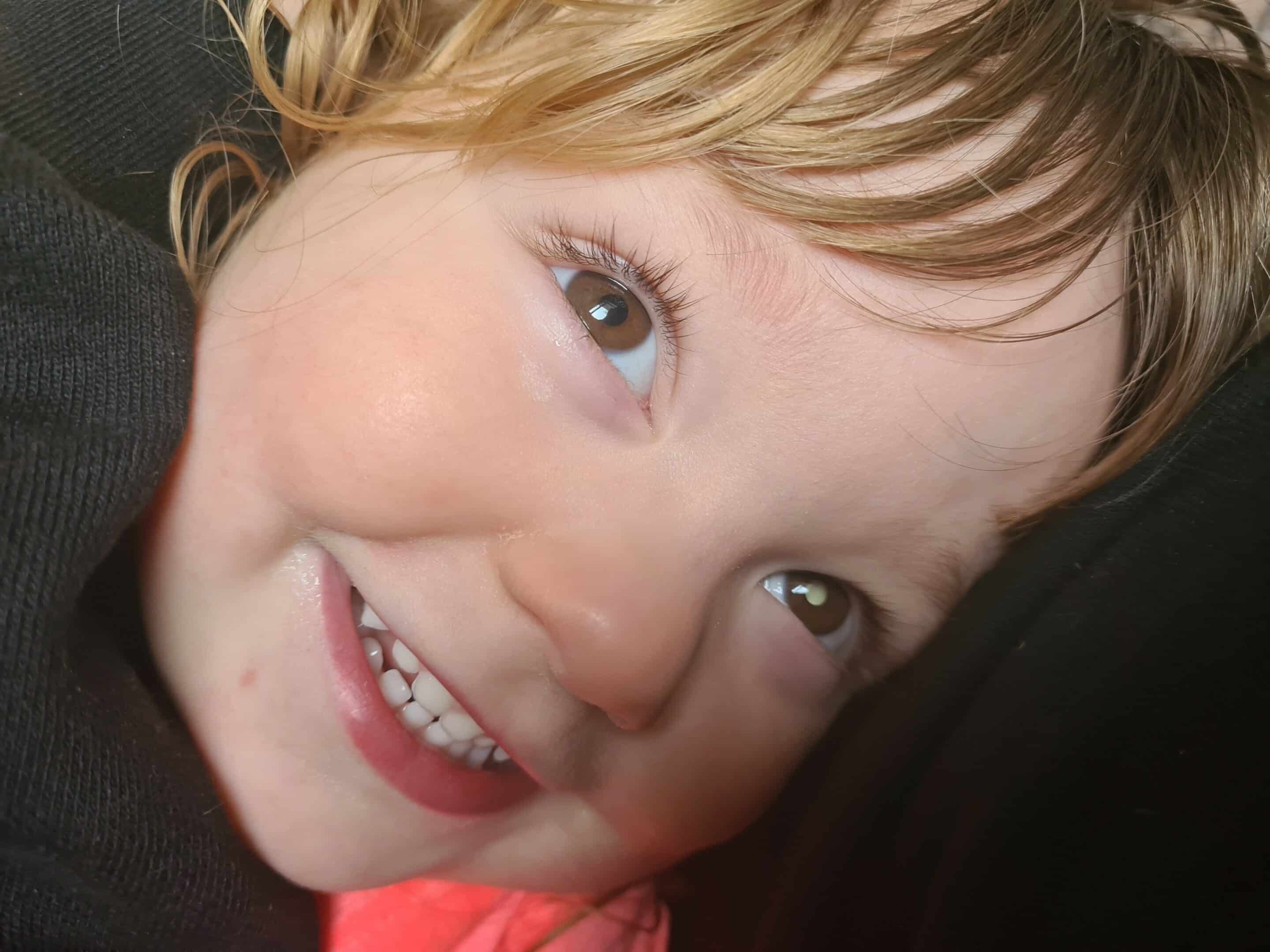 “I thought my daughter had ice in her eye, but it was retinoblastoma ...