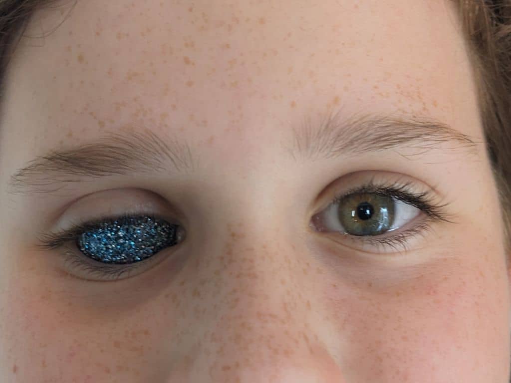Ivy’s glittery eye! | Childhood Eye Cancer Trust